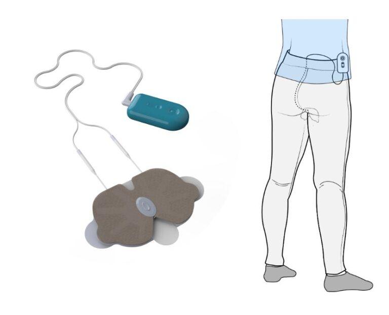 Non-Invasive and Continuous Fecal Incontinence Management - Trendlines labs